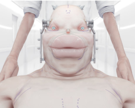 plastic surgery nightmares