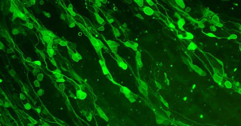 From past to present: How new neuroscience tools help us understand the ...